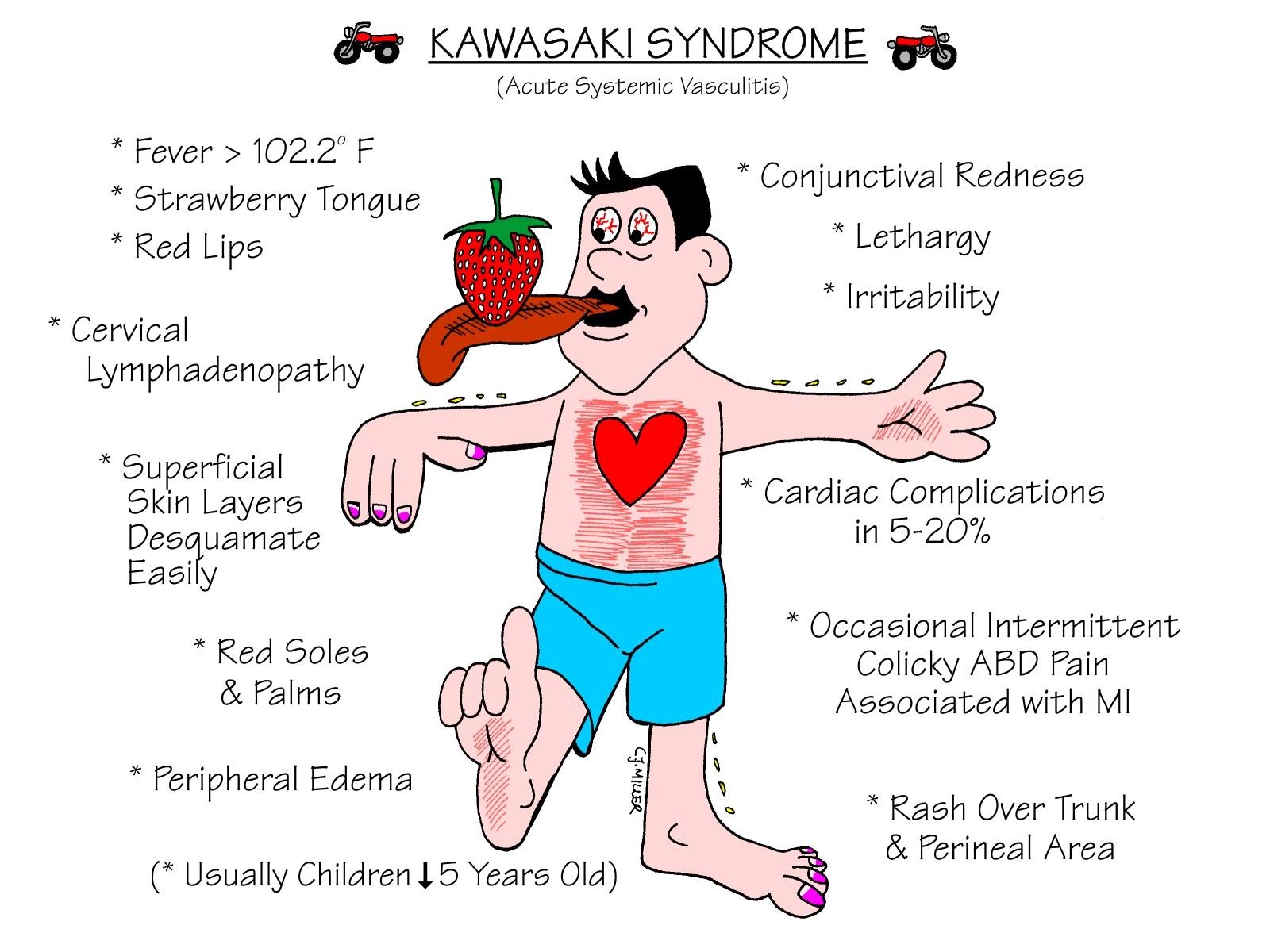 Nursing Mnemonics Kawasaki Syndrome StudyPK