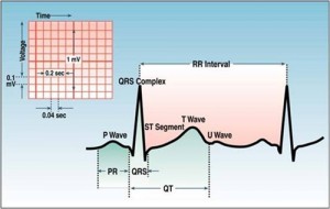 How To Read An ECG - StudyPK