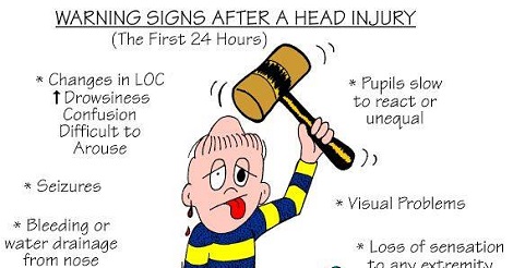 Nursing Mnemonics: Warning Signs After A Head Injury - StudyPK