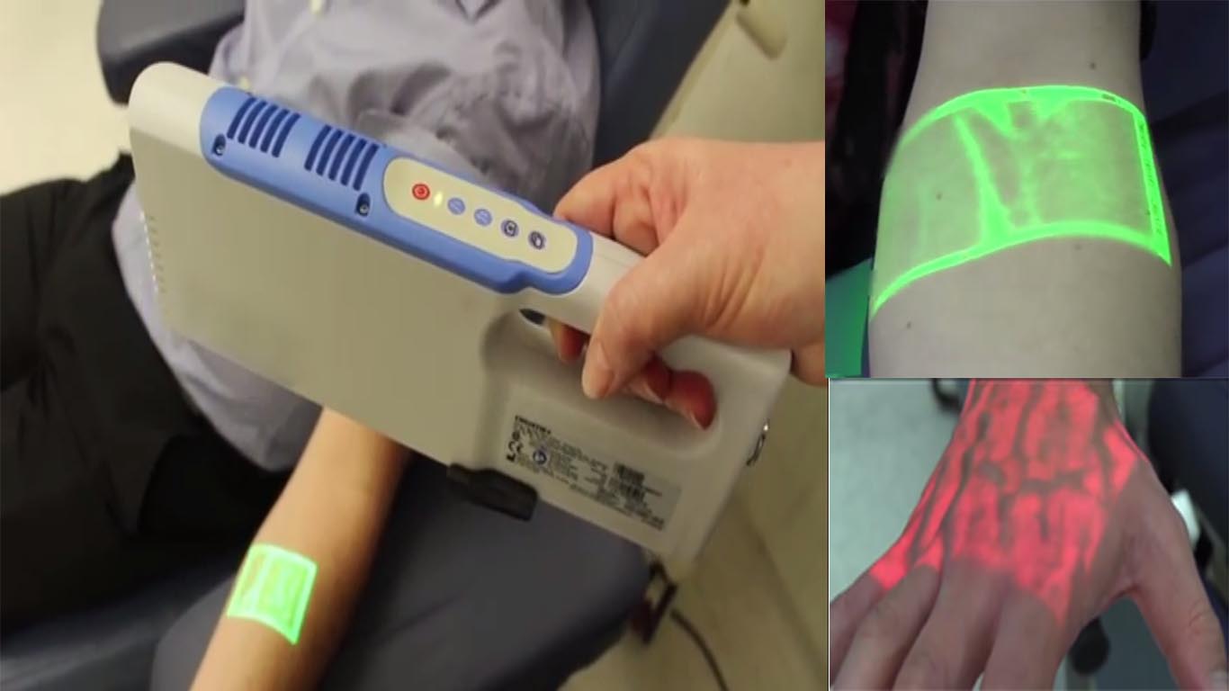 Tips on How Not to Blow Your Patients Vein - StudyPK