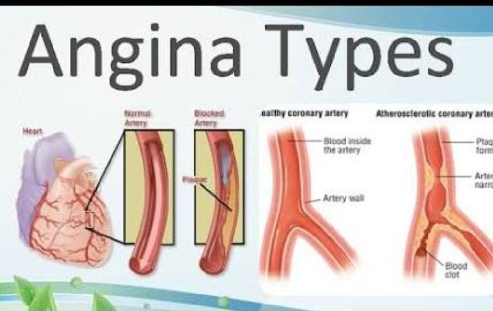 NCLEX Practice Questions: Quiz 572 - StudyPK