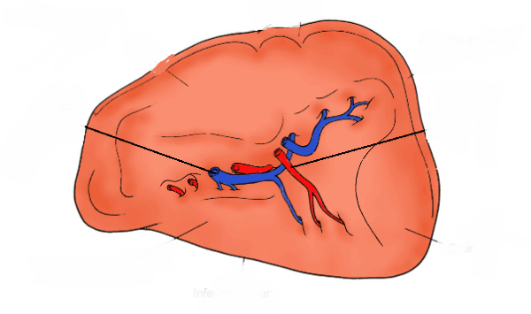 ARDMS Exam Review Questions: Quiz 483 - StudyPK