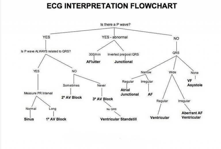 ECG Interpretation Flowchart - StudyPK