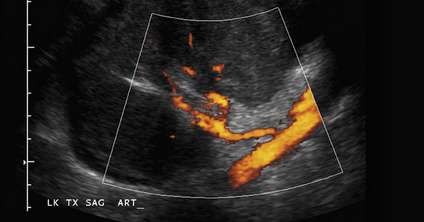ARDMS Exam Review Questions: Quiz 556 - StudyPK