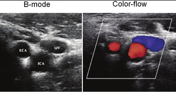 ARDMS Exam Review Questions: Quiz 616 - StudyPK