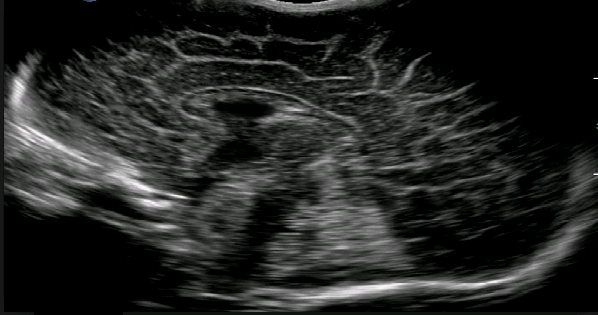 ARDMS Exam Review Questions: Quiz 733 – StudyPK