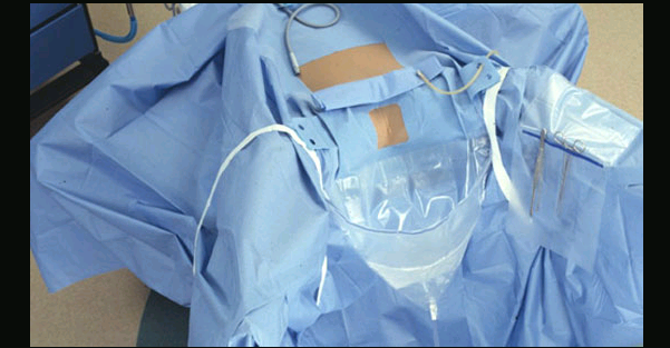 CST Exam Review Question no. 150 - StudyPK