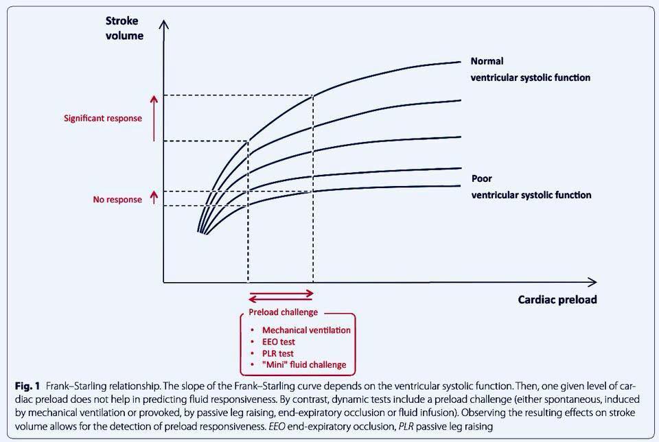Prediction of fluid responsiveness - StudyPK