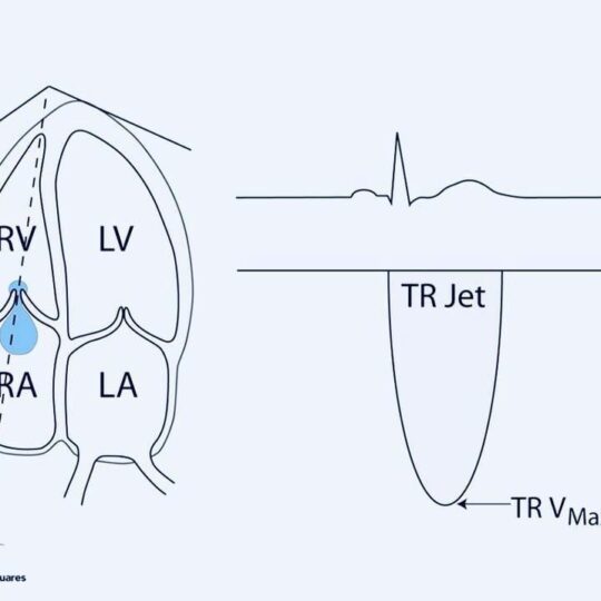 Echo Archive - StudyPK