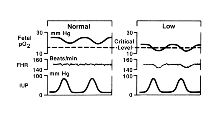 NCLEX OB Practice Questions – Fetal Well-Being - StudyPK